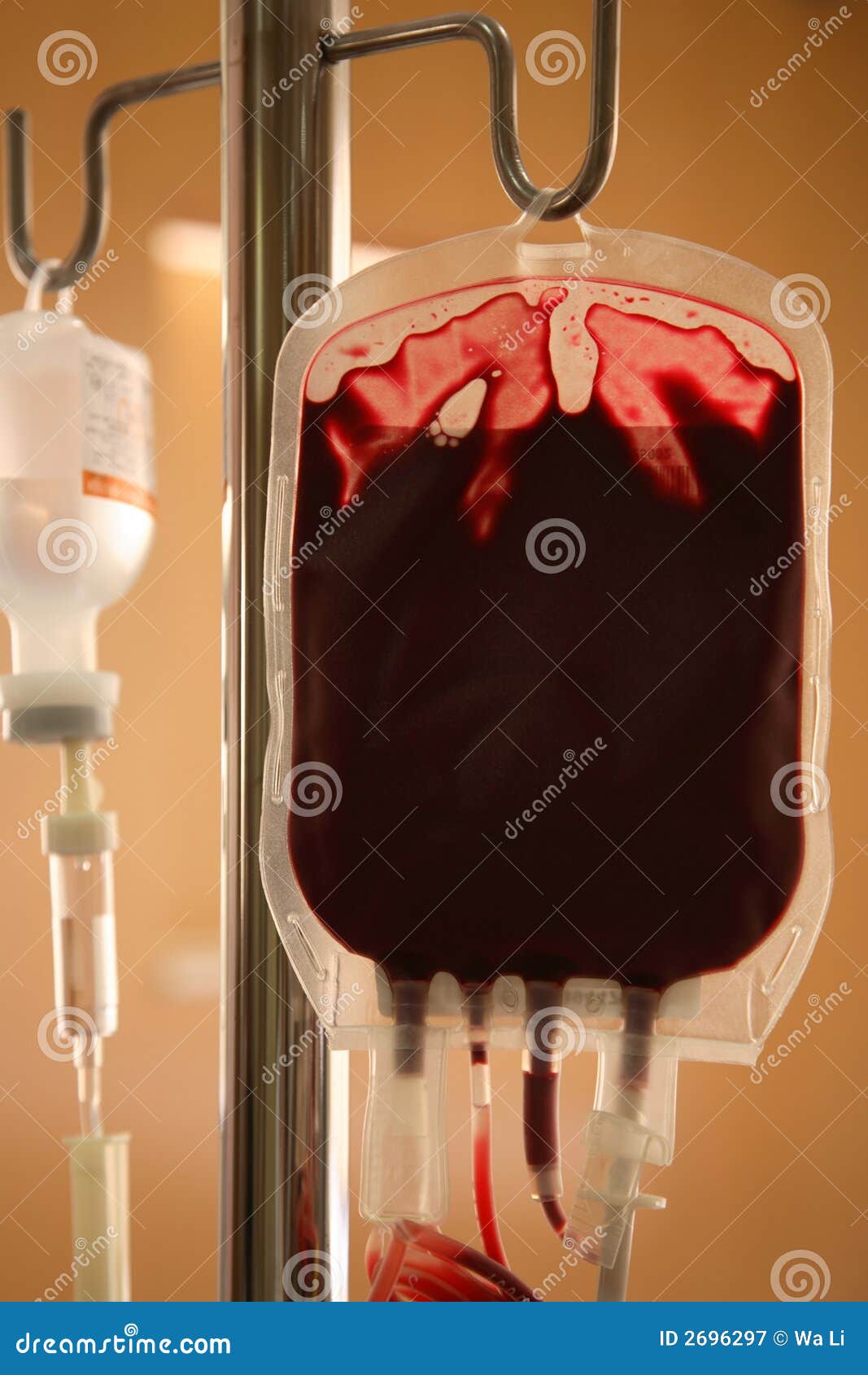 Transfusion sanguine image stock. Image du approvisionnement - 2696297