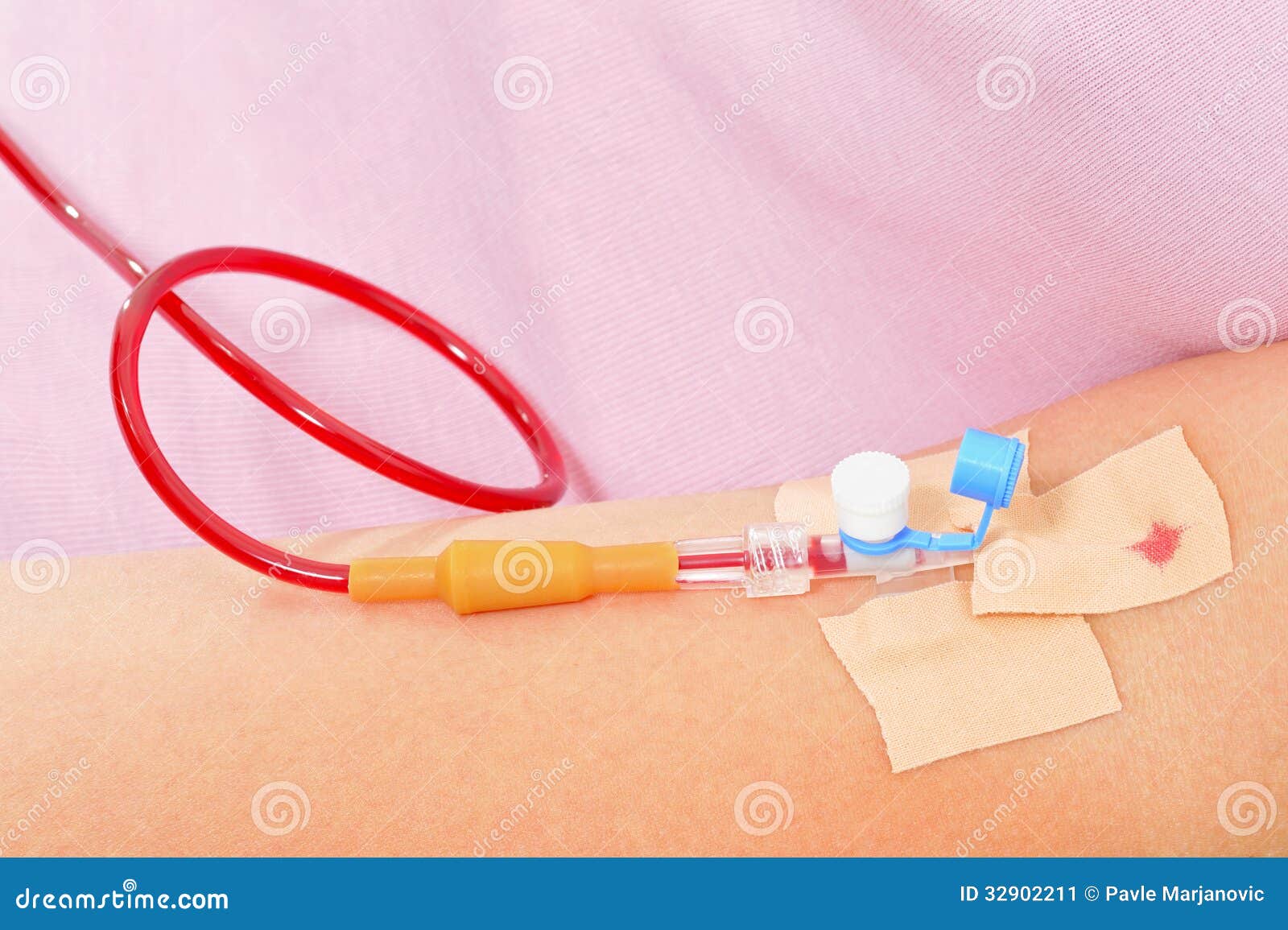 Transfusion sanguine image stock. Image du remède, gouttelette - 32902211