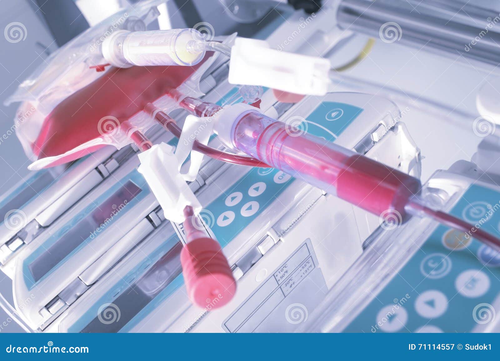Transfusion Sanguine Dans ICU Image stock - Image du choc, médecine ...