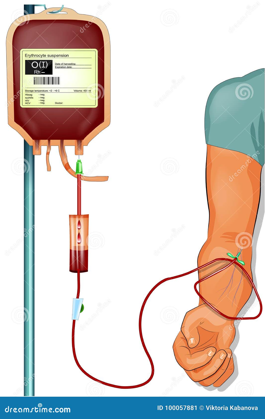 Transfusiones De Sangre Pacientes Ilustración del Vector - Ilustración ...
