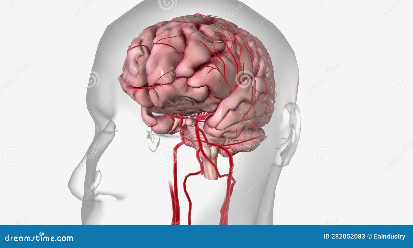 A Transient Ischemic Attack is a Mini Stroke with Similar Symptoms To ...
