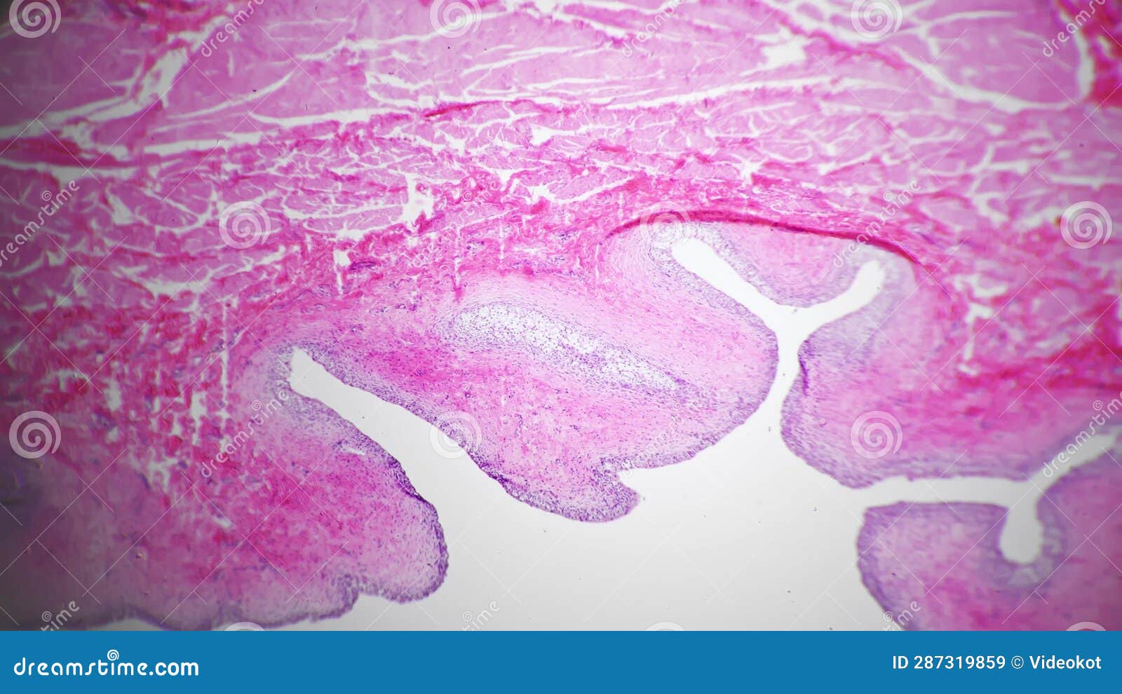 Transitional Epithelium of Man in Section Filmed Under Microscope 40x ...