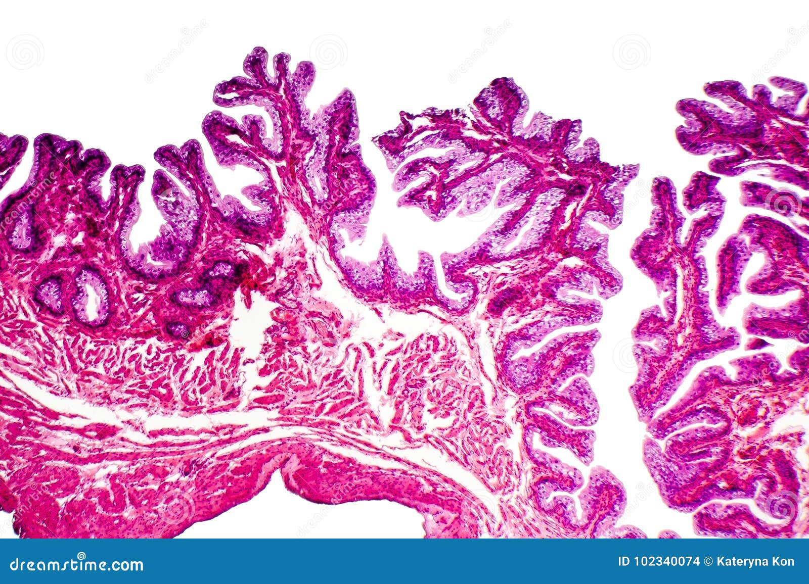 Transitional Epithelium Tissue