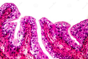 Transitional Epithelium Tissue Stock Photo - Image of medical, cell ...