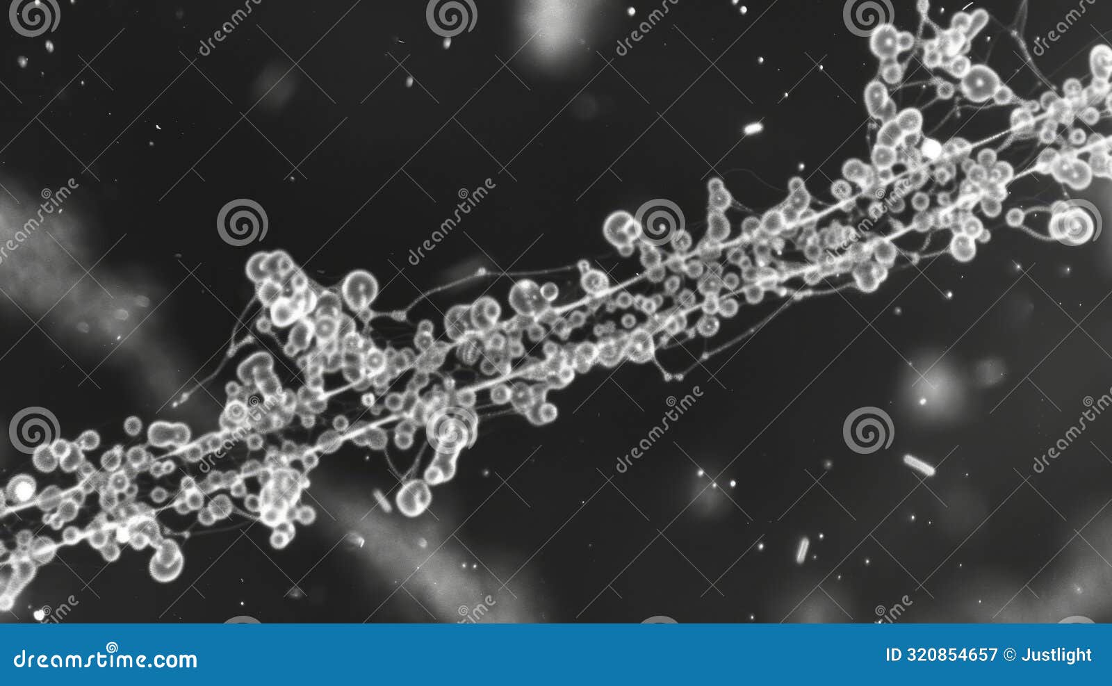 A Transmission Electron Micrograph Showing the Degradation of MRNA ...