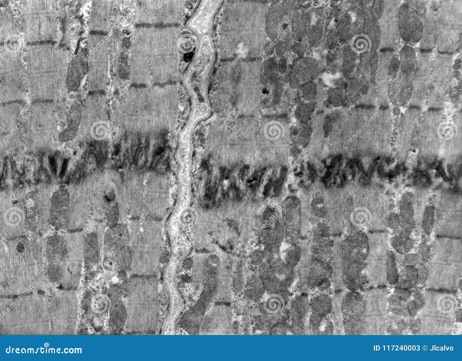 Heart Muscle, Light Micrograph Royalty-Free Stock Photo | CartoonDealer ...