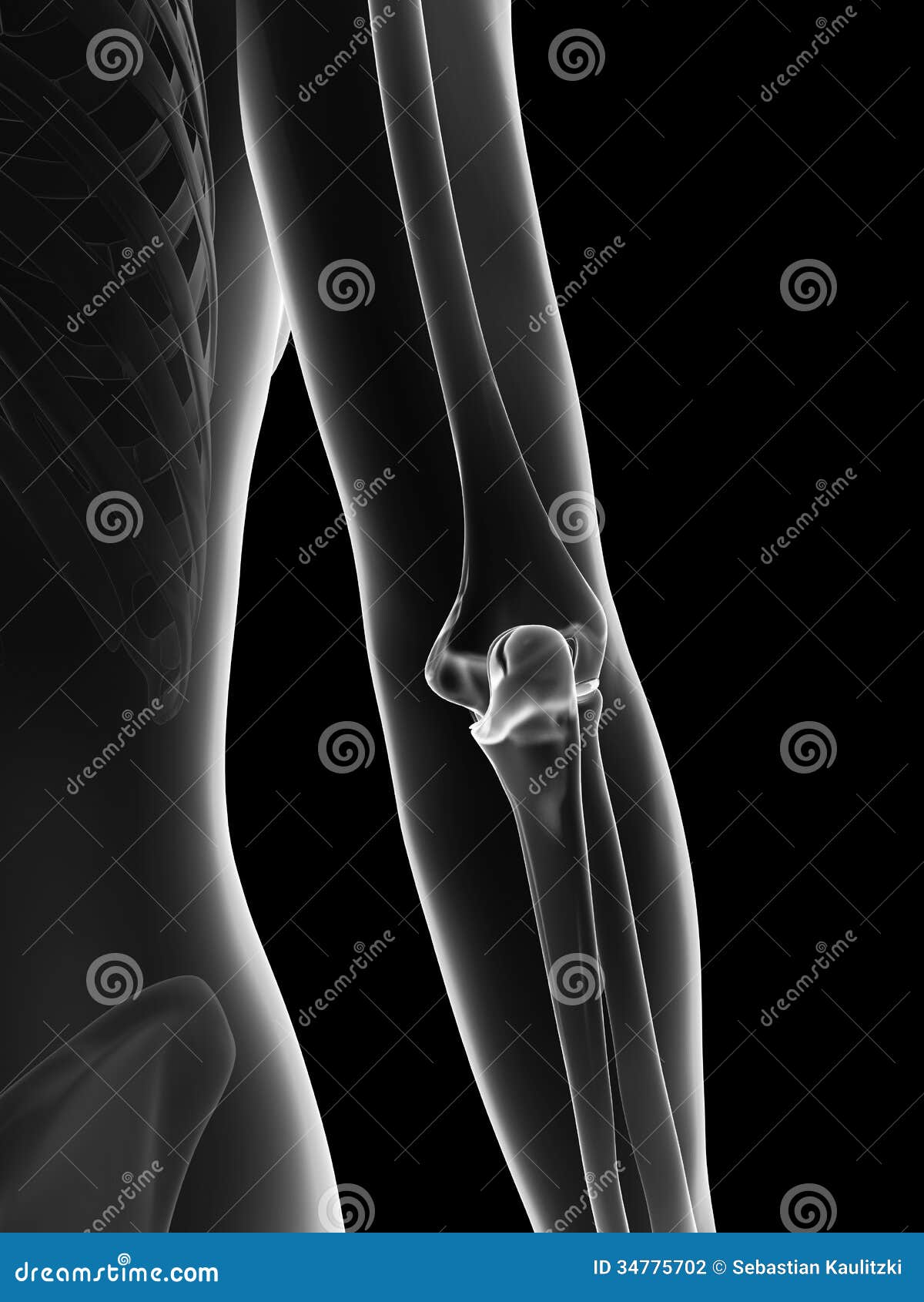 Female Radius / Ulna - Forearm - Anatomy Bones Royalty-Free Stock ...