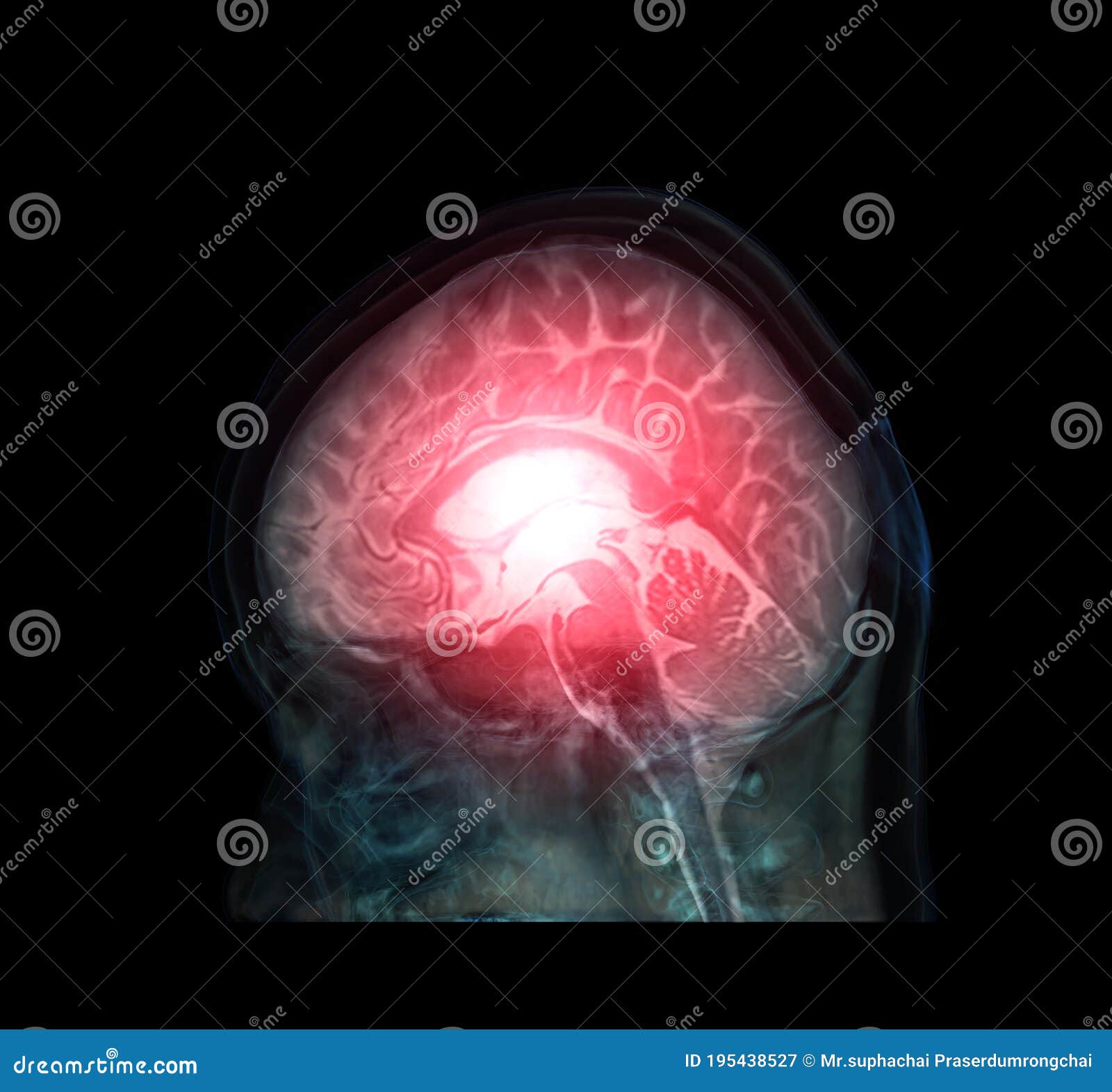 Transparent Image of the Skull with Brain for Medical Background ...