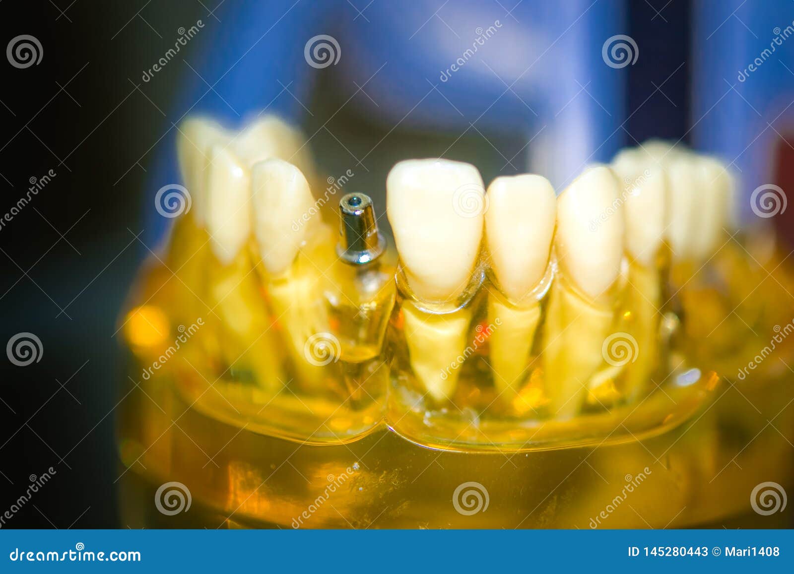Transparent Model of Human Teeth Stock Image - Image of dentist, dental ...