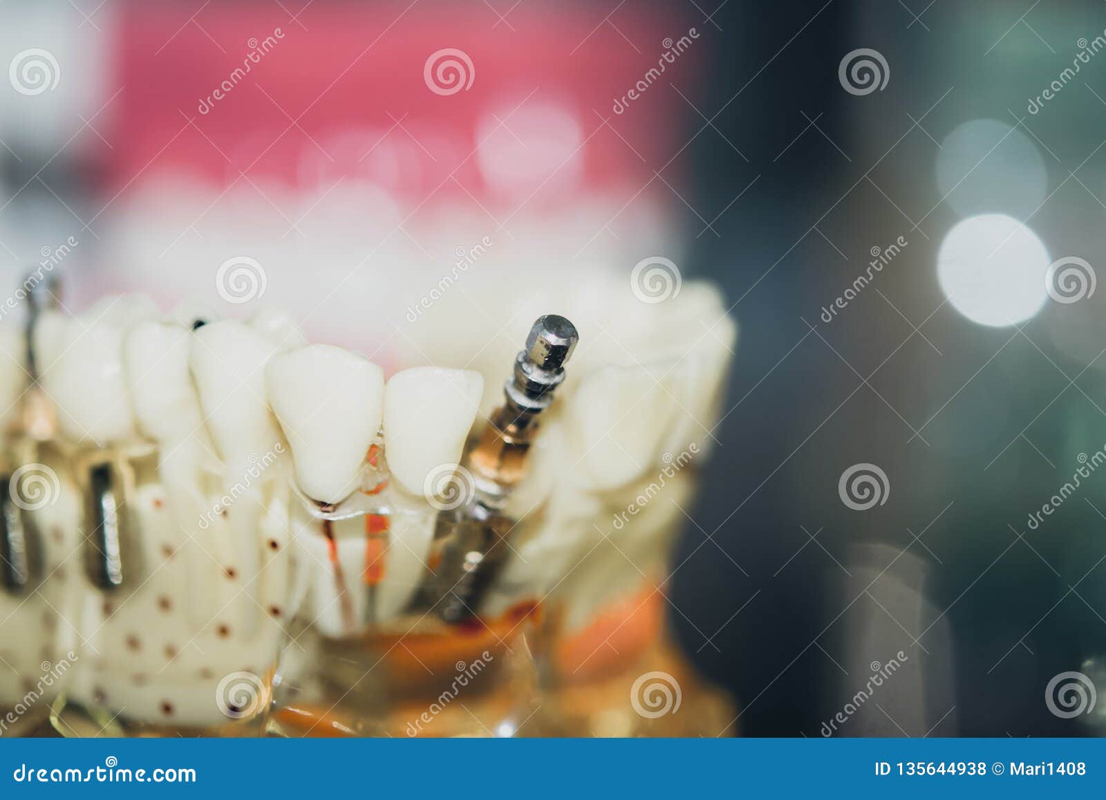 Transparent Model of Human Teeth Stock Photo - Image of oral, abangment ...