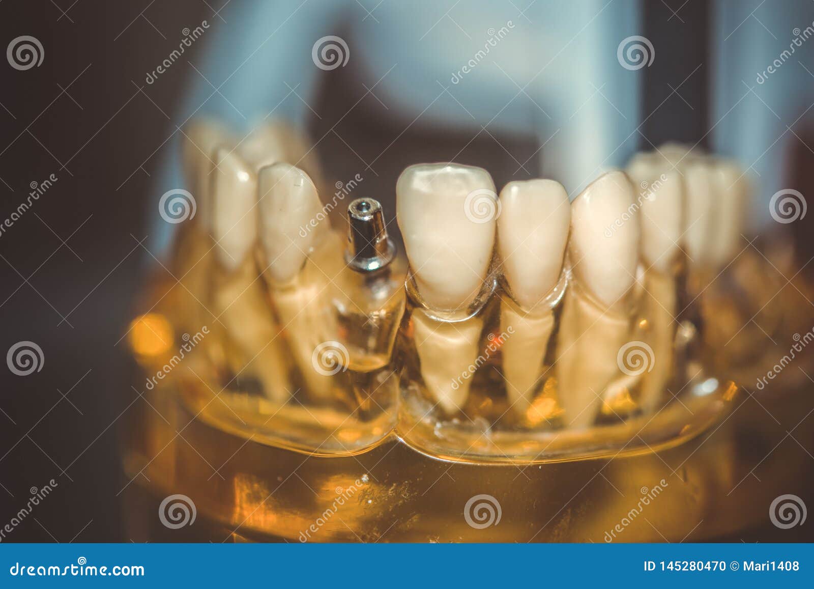 Transparent Model of Human Teeth Stock Photo - Image of artificial ...