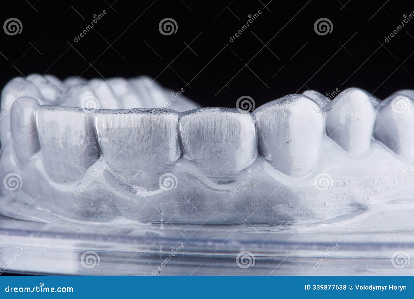 Transparent Orthodontic Splint for Aligning the Position of Teeth ...