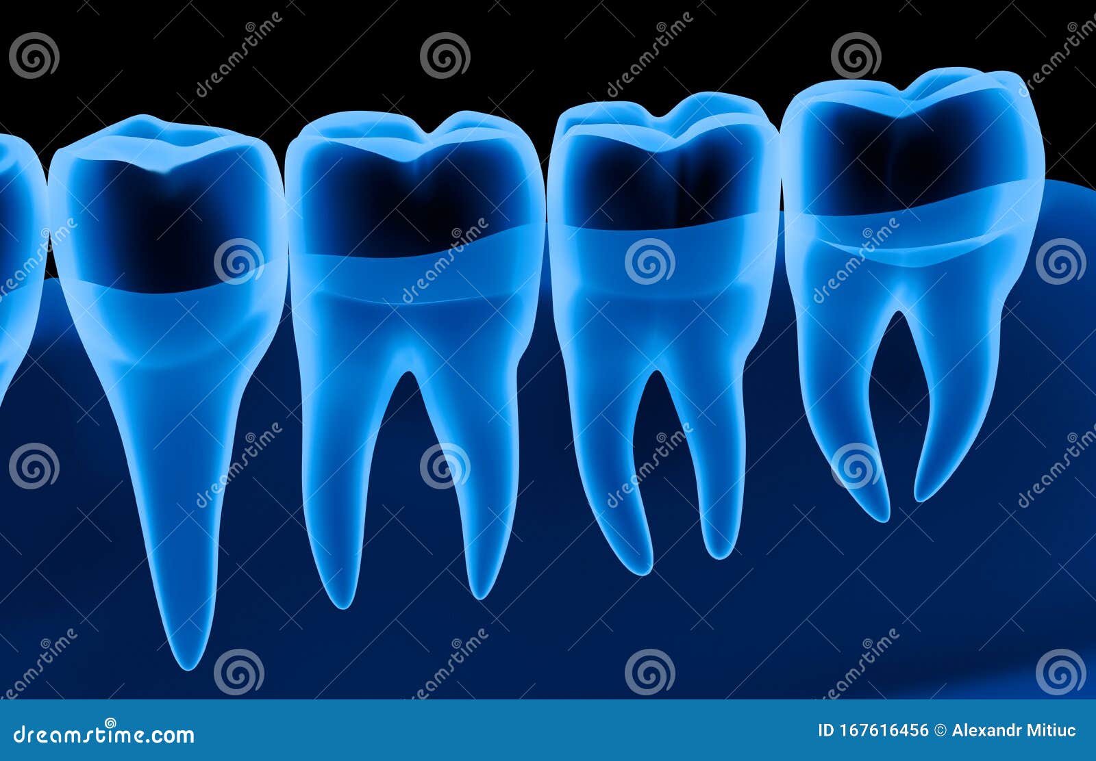 Transparent Teeth Scan, Xray View Stock Illustration - Illustration of ...
