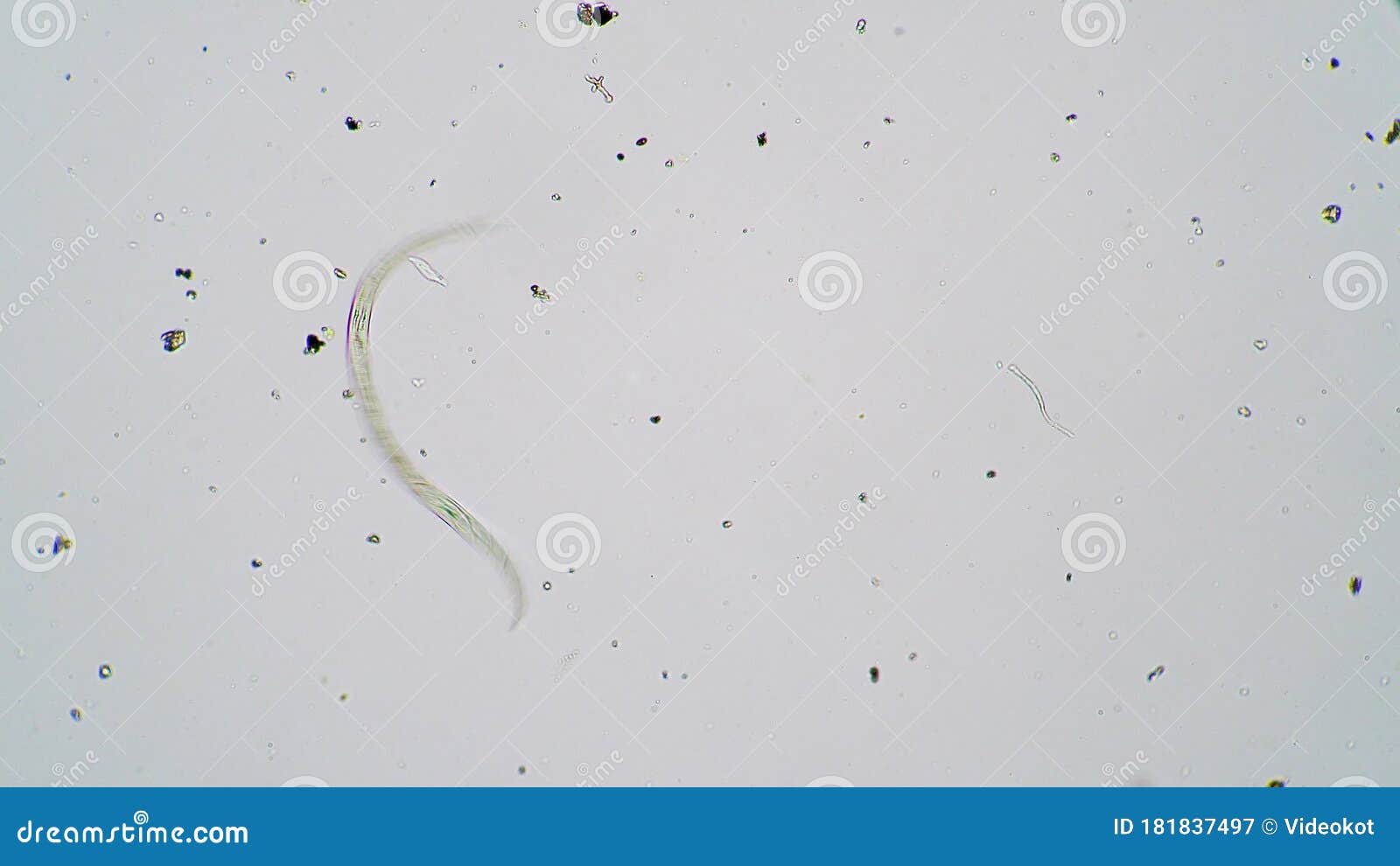 The Transparent Worm is Wiggling and Moving Down in Magnification of ...