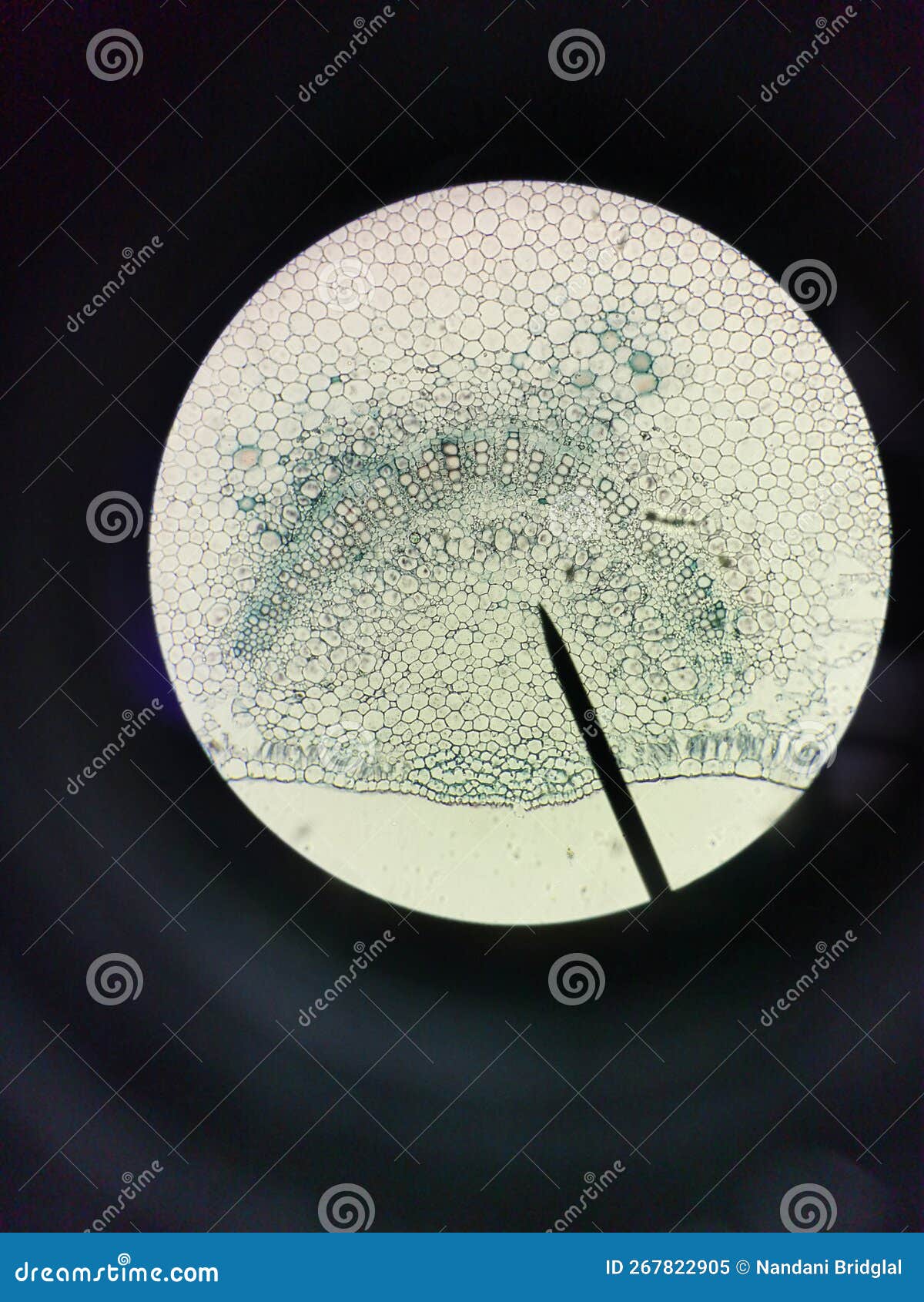 Transverse Section of an Allamanda Leaf Stock Image - Image of organ ...