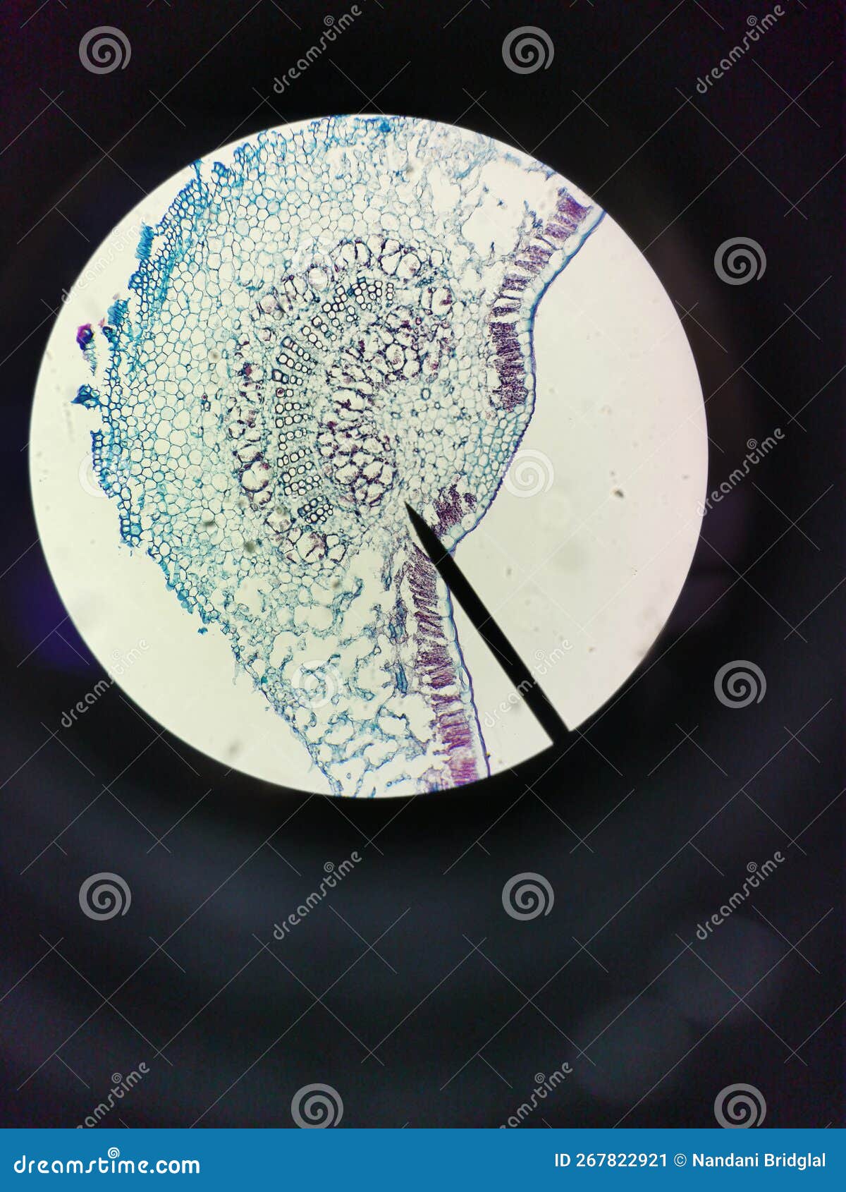 Transverse Section of an Allamanda Leaf Stock Image - Image of compound ...