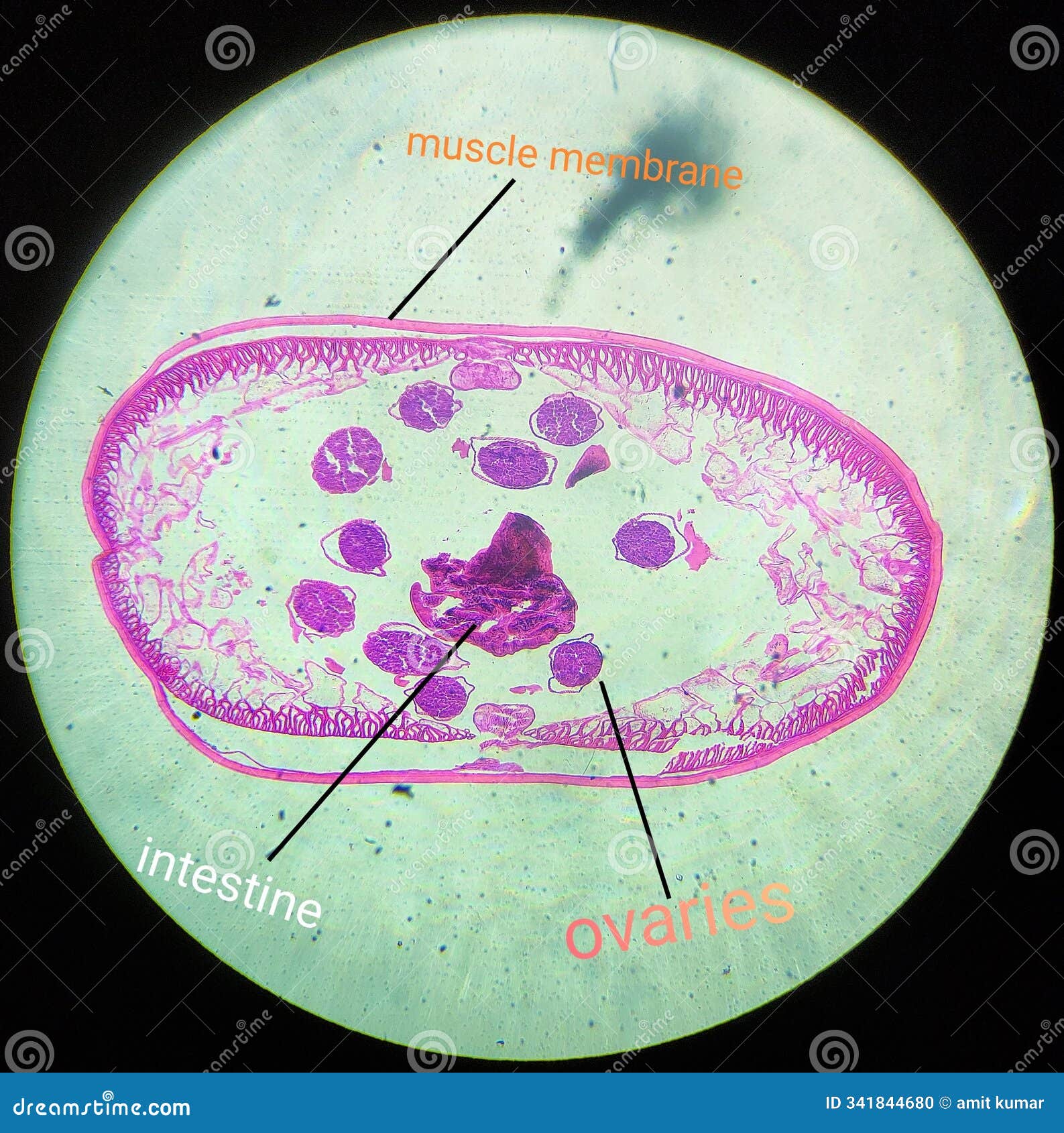 Transverse Section Of The Metacarpal Bone In The Old Book Atlas Der ...