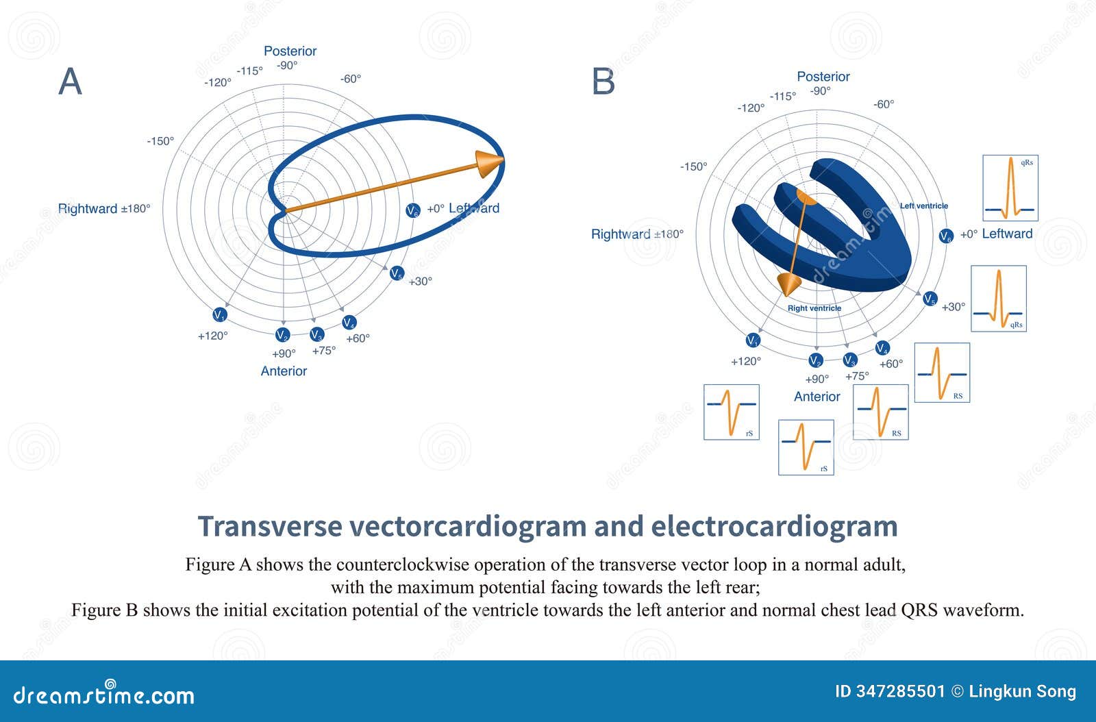 Transverse Vectorcardiogram and Electrocardiogram Stock Illustration ...
