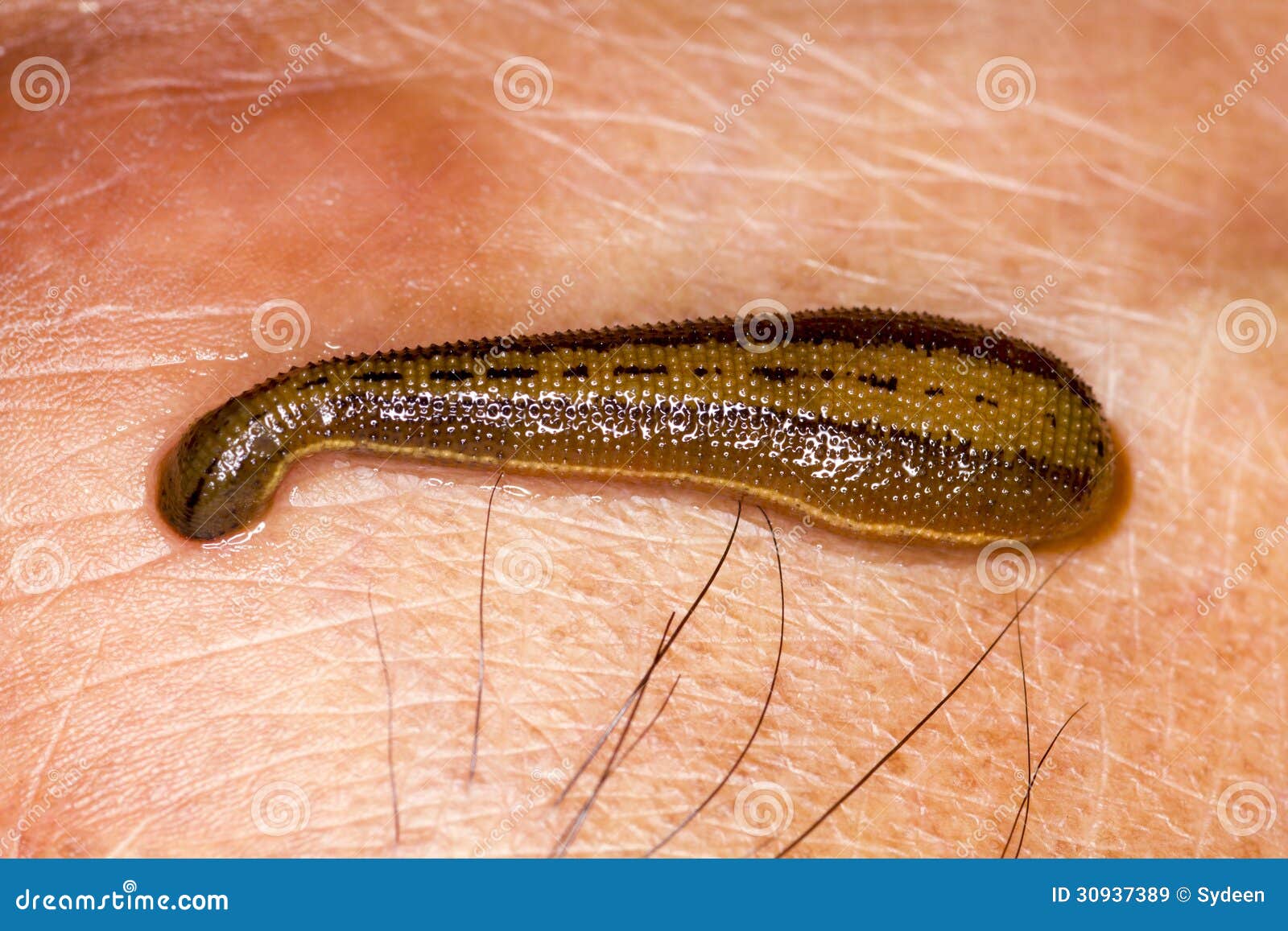 Tratamento da sanguessuga imagem de stock. Imagem de espécime - 30937389