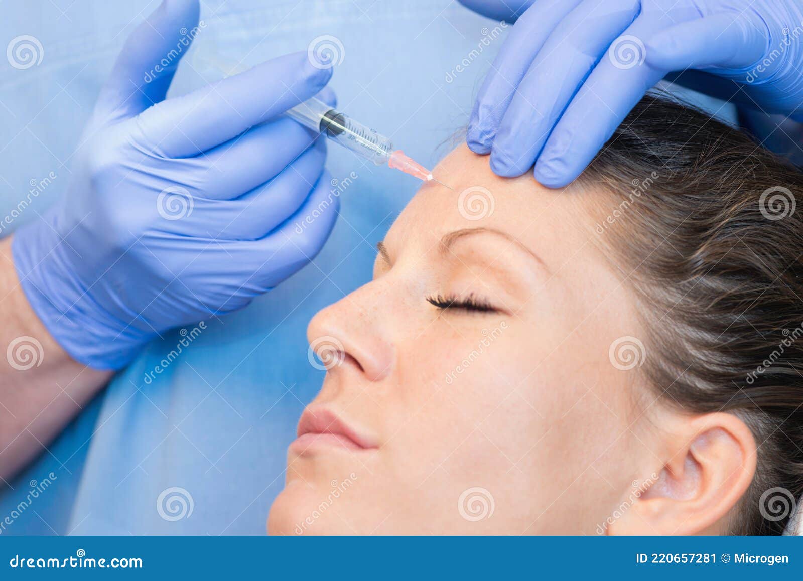 Tratamiento Con Botox En La Mujer Imagen de archivo - Imagen de cuidado ...