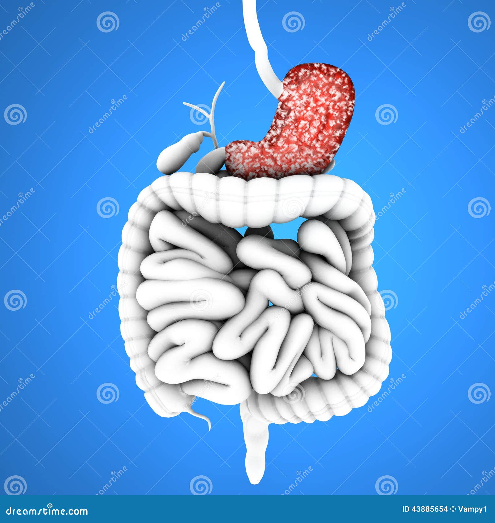 Trato Digestivo, Estômago E úlceras, Ilustração Stock - Ilustração de ...
