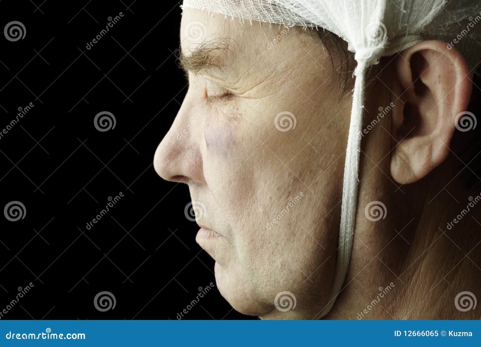 Trauma stock image. Image of white, portrait, caucasian - 12666065