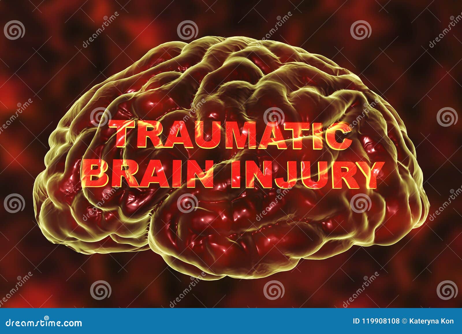Traumatic brain injury stock illustration. Illustration of inscription ...