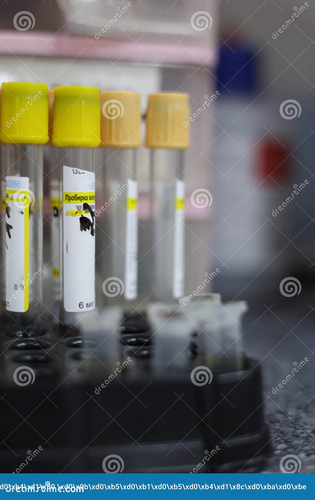 In the Tray are Test Tubes with Blood for Research. in the Laboratory ...