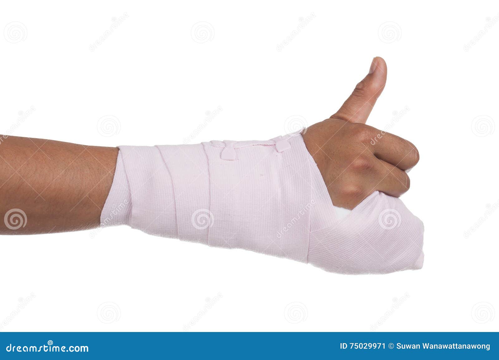 Treat Broken Bone Hand by Splint Stock Image - Image of plaster, splint ...