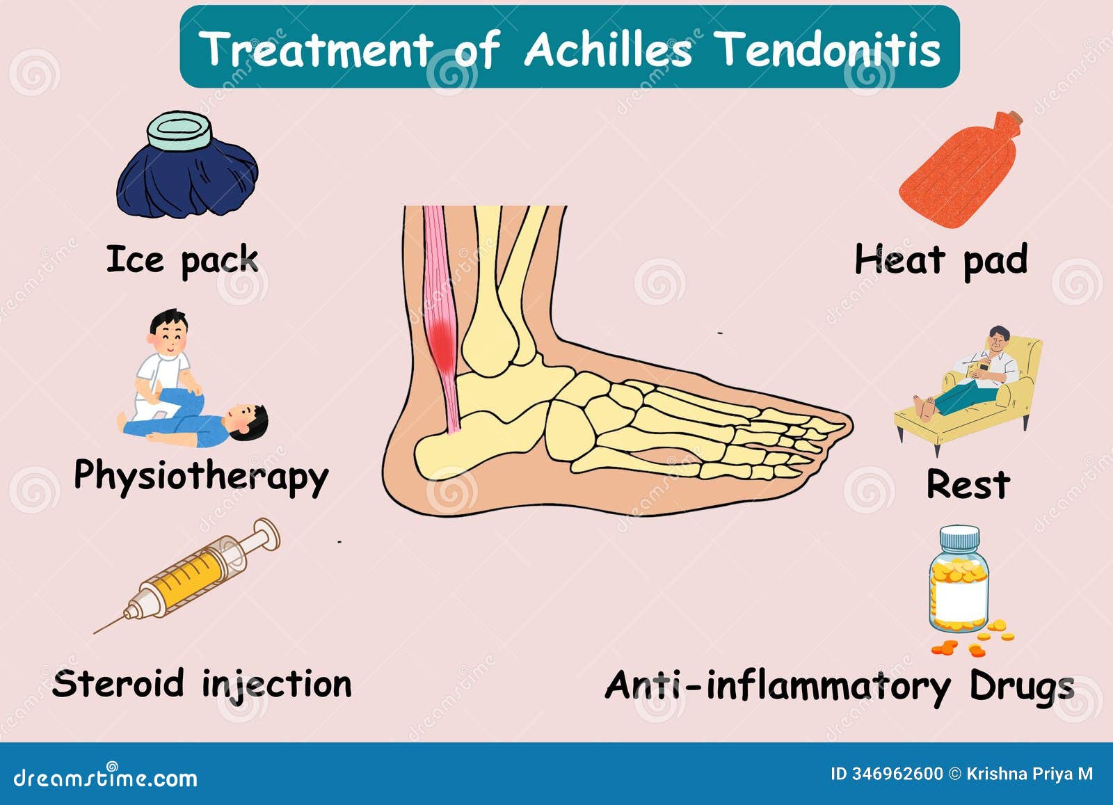 Achilles Tendonitis Patient Education | Futures Education