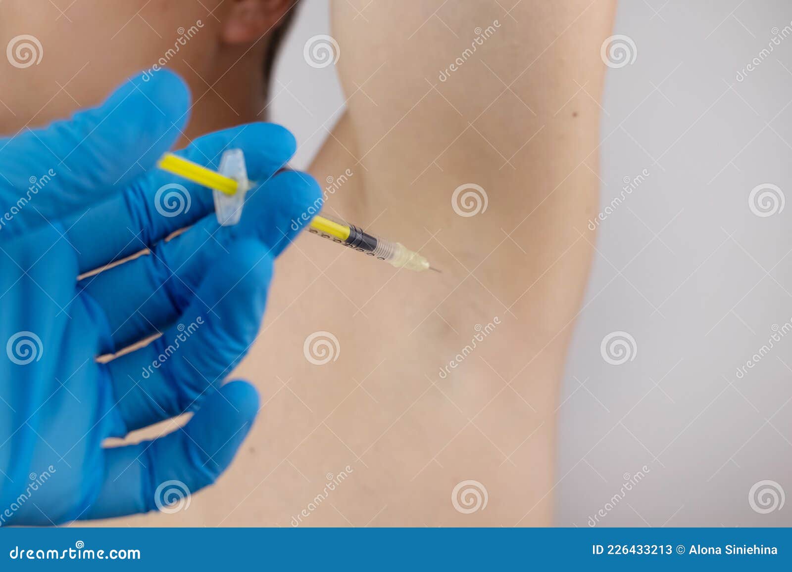 Man Receiving Botox Injection In Armpit As Treatment Of Hyperhidrosis