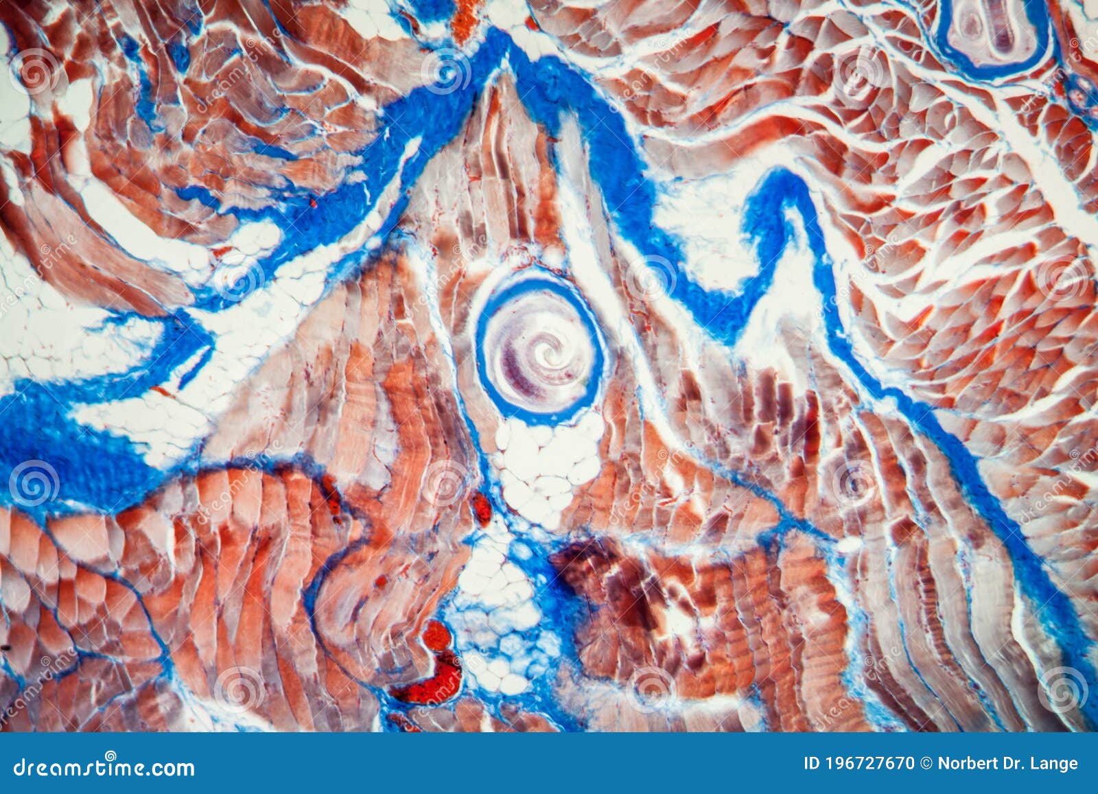Trichinic Parasites in Muscle Tissue Stock Photo - Image of medicine ...