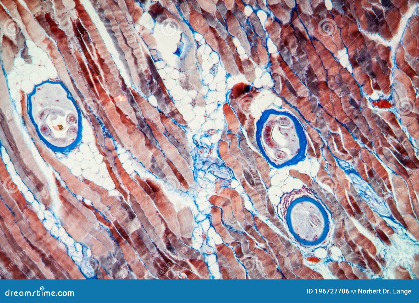 Trichinic Parasites in Muscle Tissue Stock Photo - Image of tissue ...