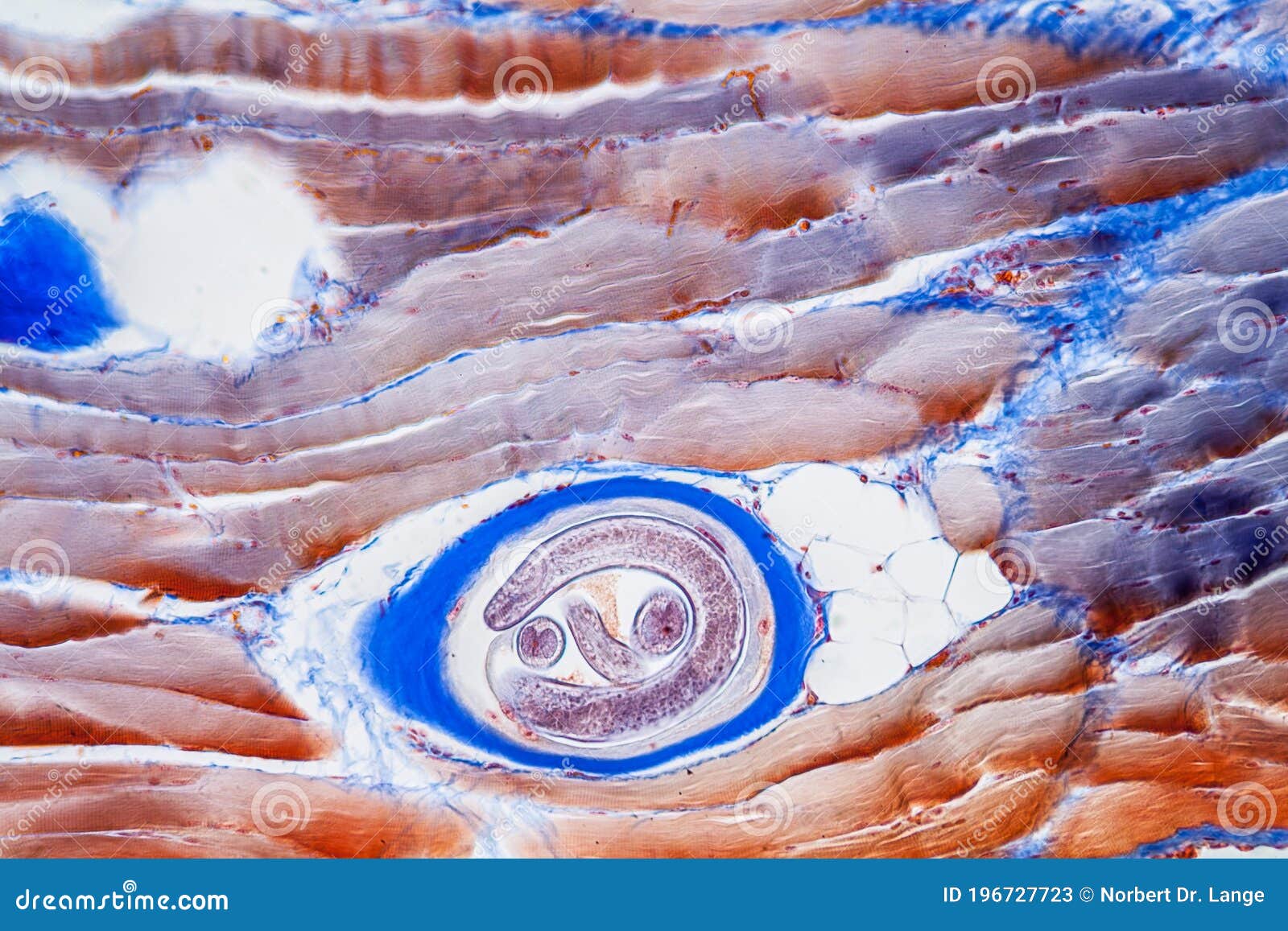 Trichinic Parasites in Muscle Tissue Stock Image - Image of muscle ...