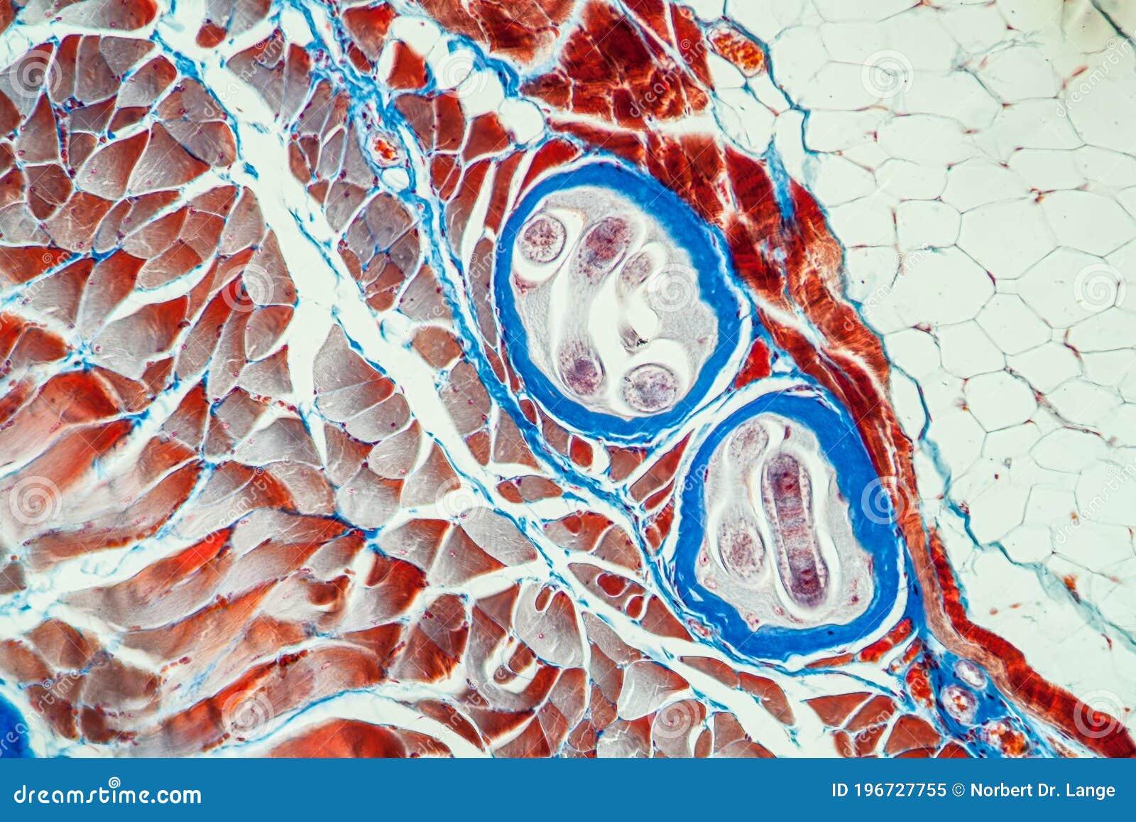 Trichinic Parasites in Muscle Tissue Stock Image - Image of tissue ...
