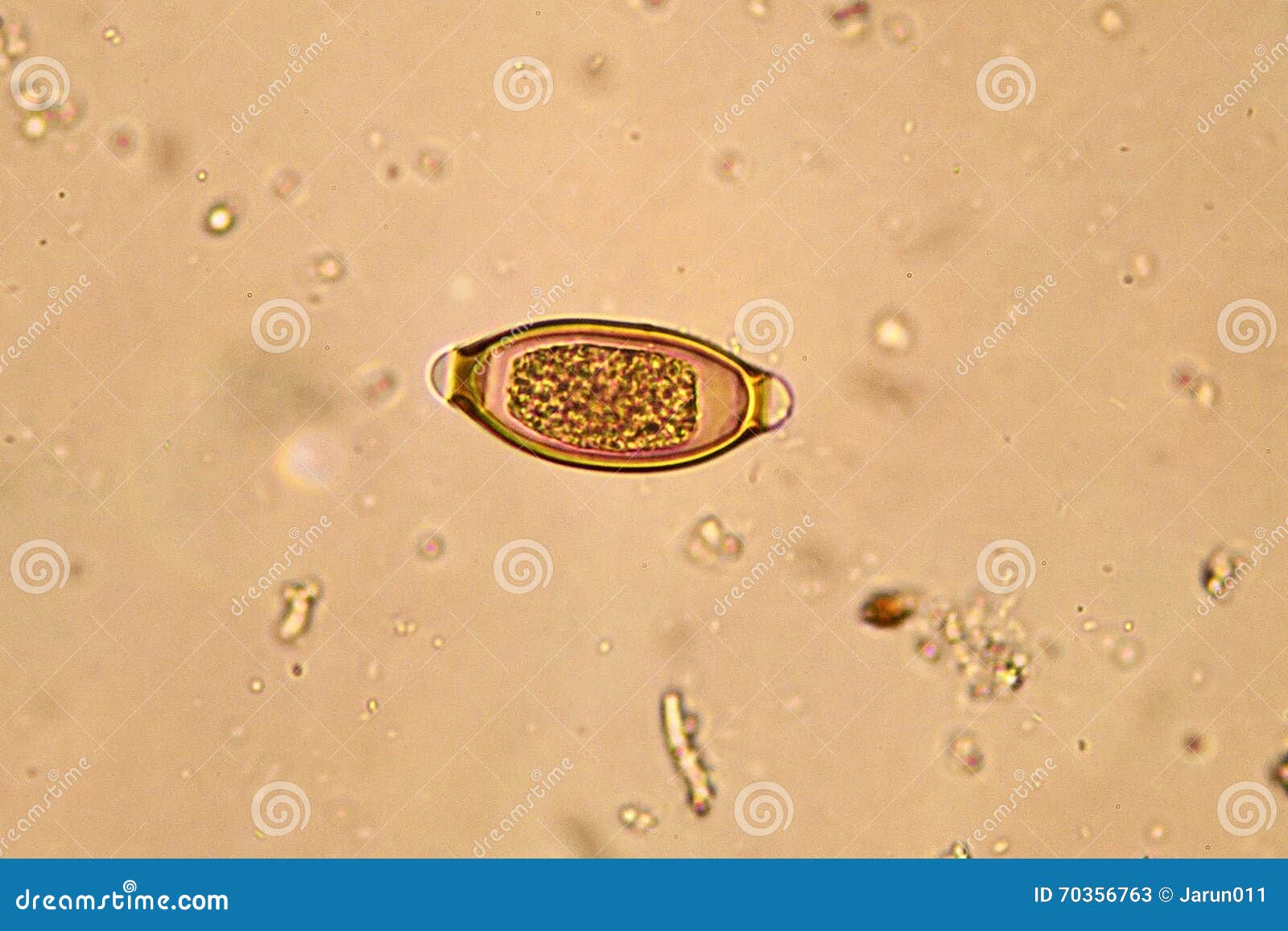 Trichiura de Trichuris imagen de archivo. Imagen de médico - 70356763