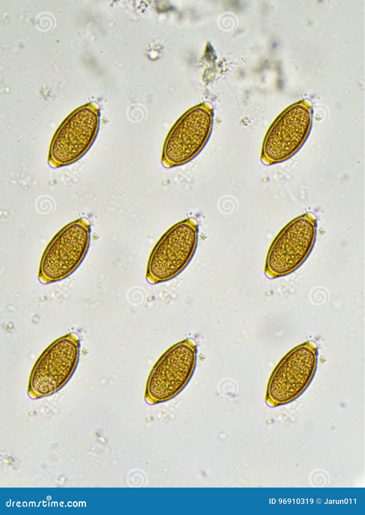 Trichiura de Trichuris imagem de stock. Imagem de paciente - 96910319