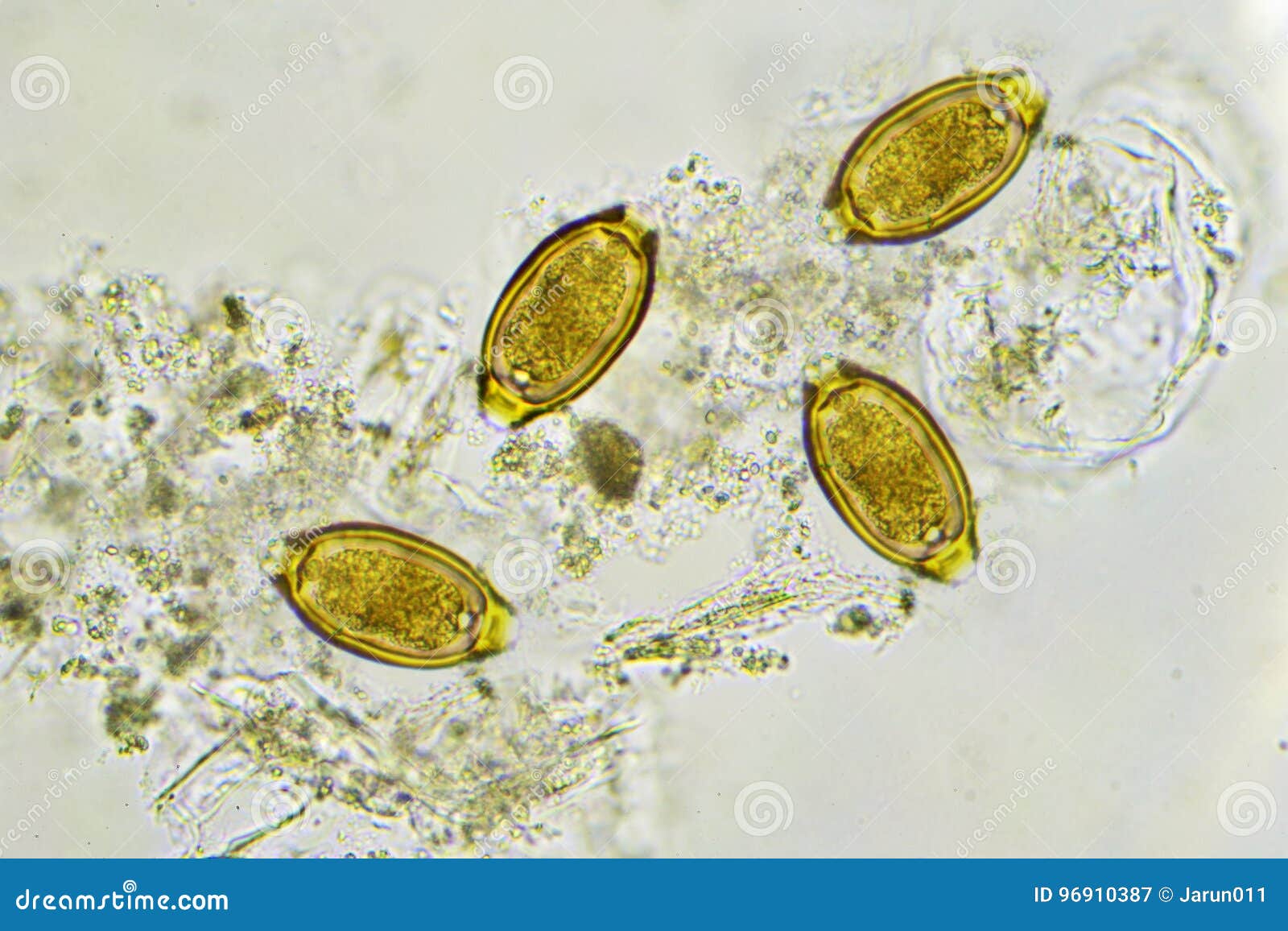 Trichiura de Trichuris imagem de stock. Imagem de ciência - 96910387