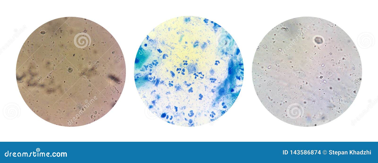 Trichomonas Microscopic View Sexually Transmitted Disease STD Stock ...