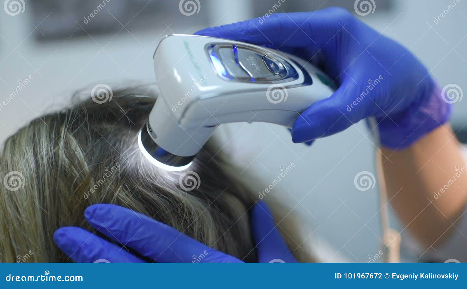 Trichoscopy is a Method of Examining Hair Stock Footage - Video of ...
