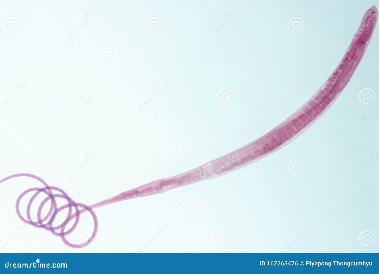 Trichuris Trichiura Under the Microscope. Stock Photo - Image of ...