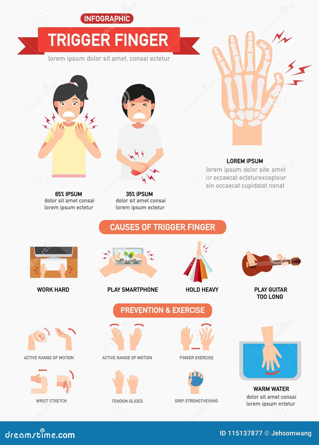Triggerfinger infographic vektor abbildung. Illustration von mann ...