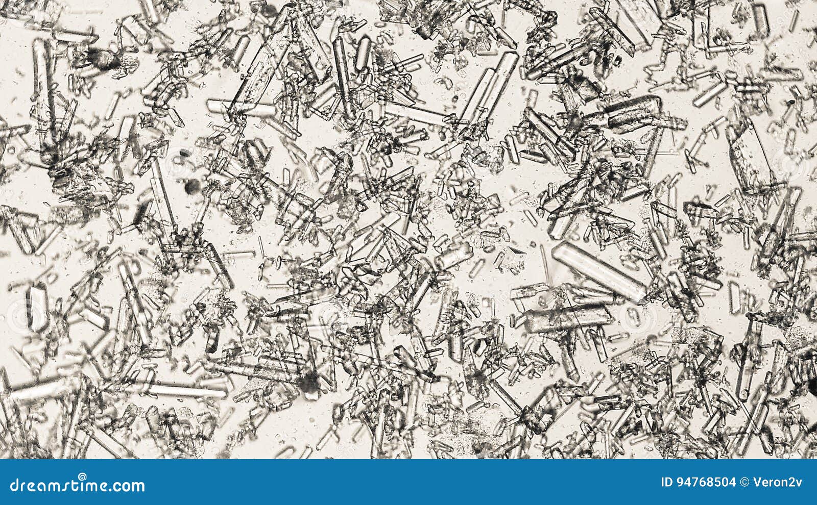 Triple Phosphate Crystals in Human Urine Sediment Stock Photo - Image ...