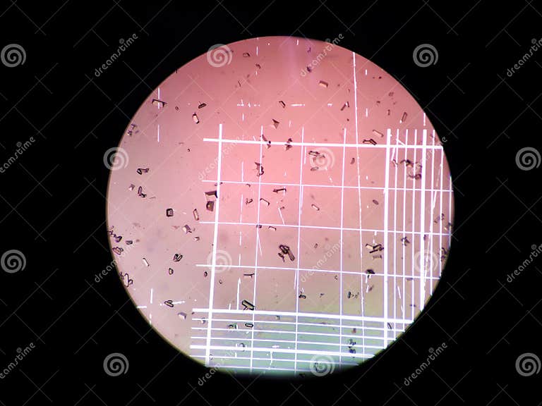Triple Phosphate Crystals on Urine Test Stock Image - Image of stain ...