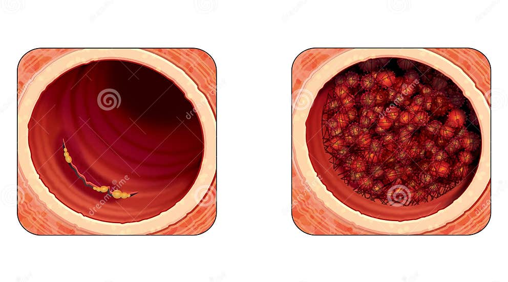 Trombo mural ilustración del vector. Ilustración de ataque - 25621312