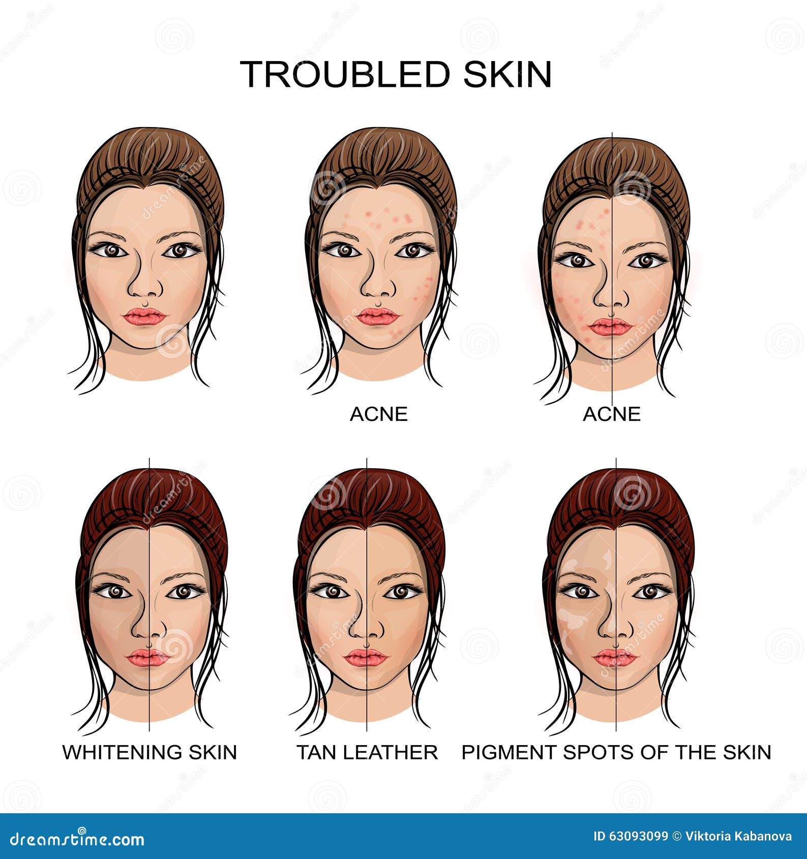 Troubled Skin and Healthy Skin Stock Vector - Illustration of ...