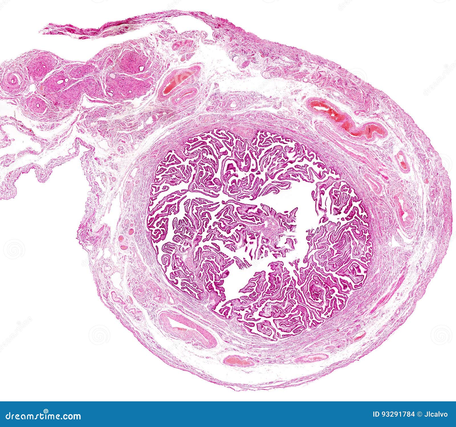 Tuba di Falloppio umana fotografia stock. Immagine di strato - 93291784