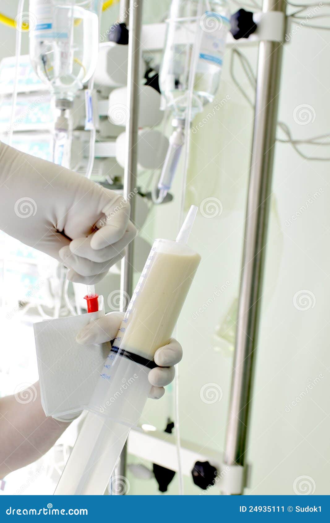 Tube Feeding Patient in the ICU Stock Image - Image of feeding, hand ...