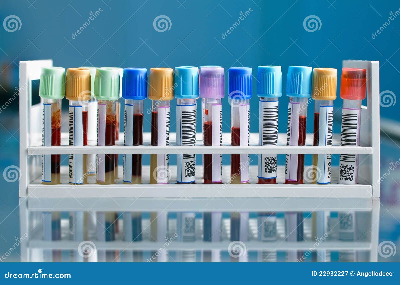 Tube rack stock image. Image of biochemistry, analysis - 22932227