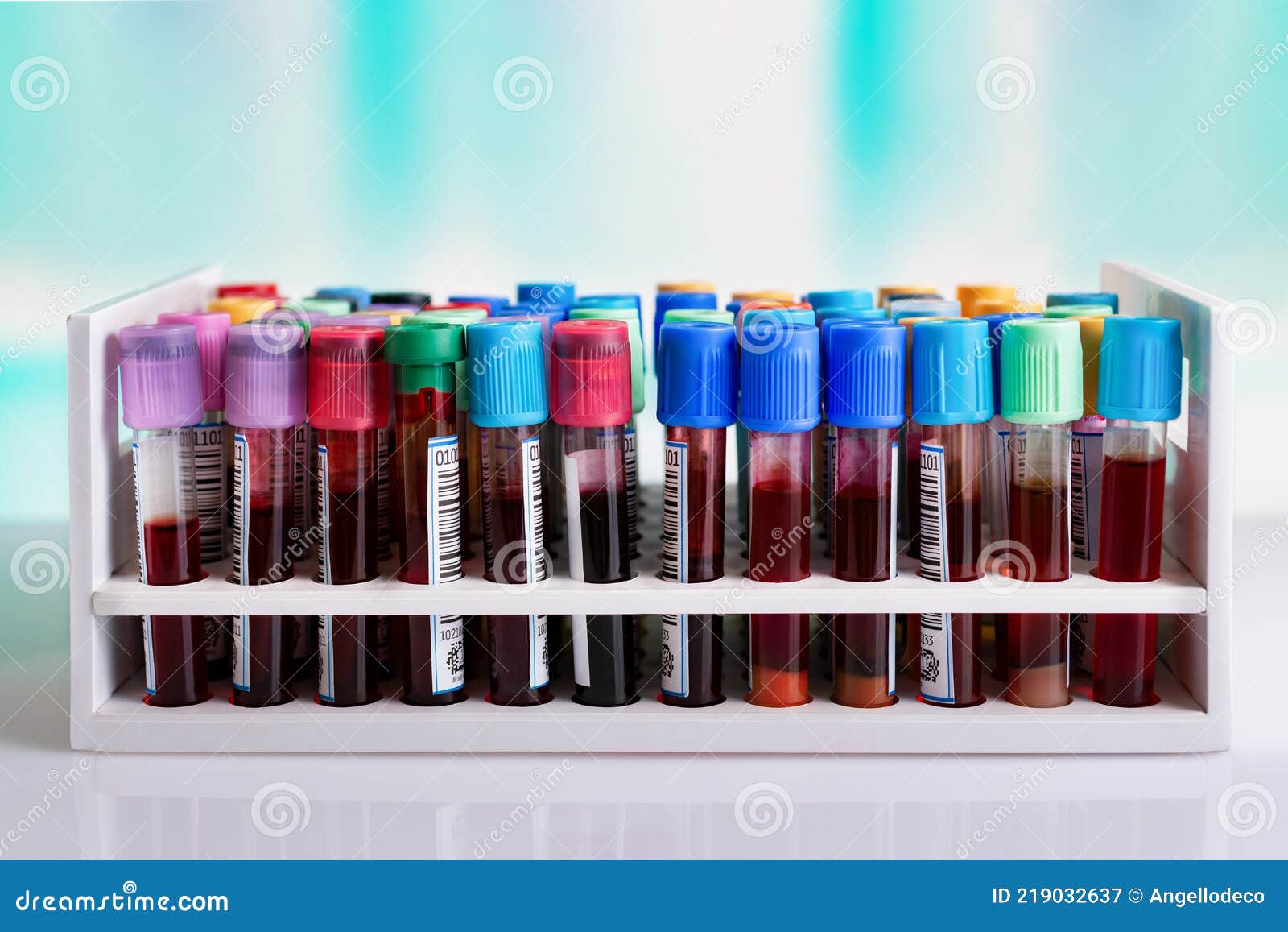 Tube Tray with Blood Tubes Samples for Testing in the Preanalytical Lab ...